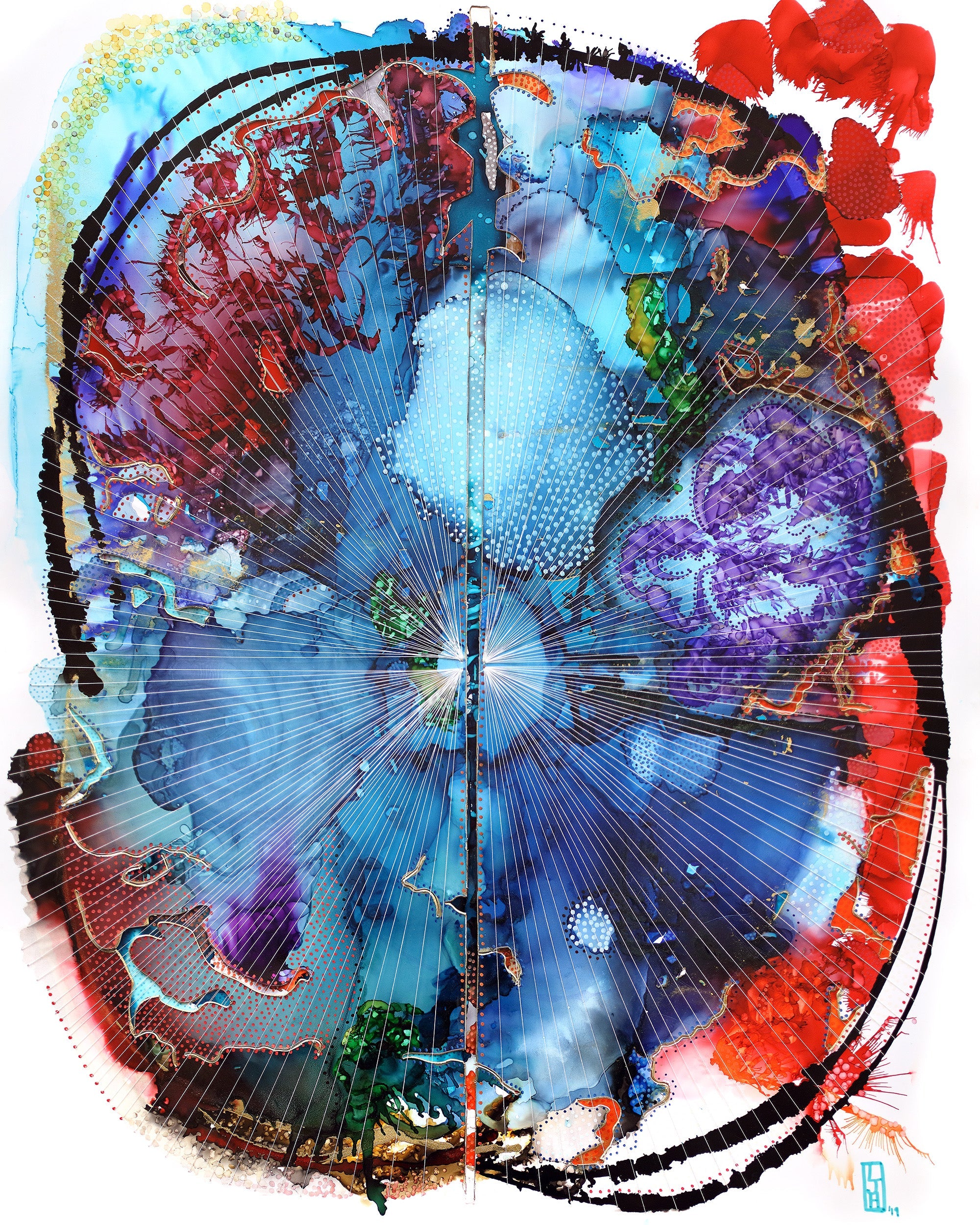 Artist's MRI – ArtLifting